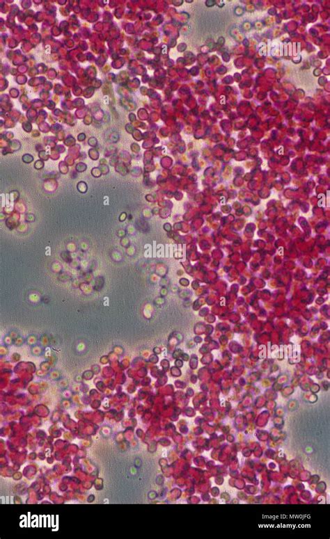 Saccharomyces Cerevisiae Under Light Microscope