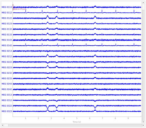 Simulate Raw Data Using Subject Anatomy — Mne 170dev103ge05e77c92