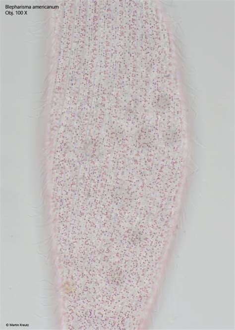 Blepharisma Americanum Real Micro Life