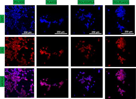 The In Vitro Cellular Uptake And Accumulation Cell Imaging Of The Download Scientific Diagram