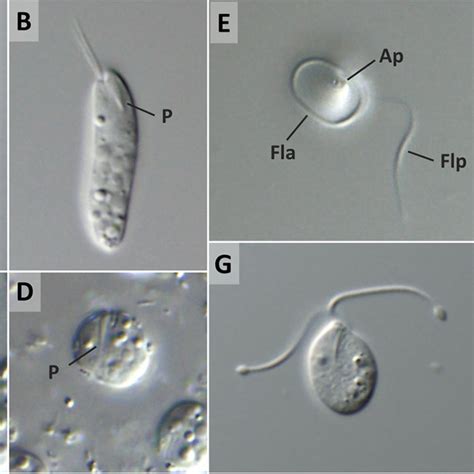 1 Phormidium Chalybeum 2 Planktothrix Planktonica 3 Planktothrix
