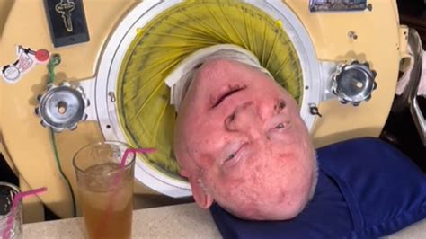 Iron Lung Man Paul Alexanders Cause Of Death Is Revealed After Polio