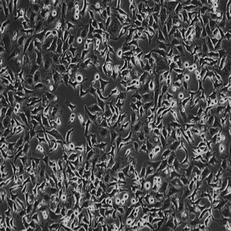 人宫颈癌细胞（hela） 细胞系 南京森贝伽生物科技有限公司