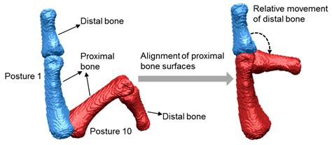 Applied Sciences Free Full Text Estimation Of Finite Finger Joint