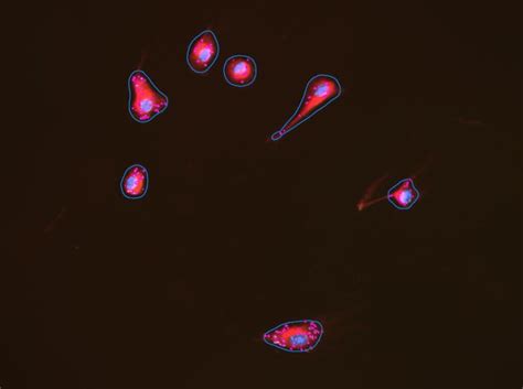 2d Automated Analysis Image Pro Media Cybernetics 2d Automated Analysis Image Pro Media Cybernetics