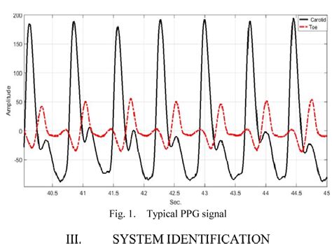 Figure 1 From Pulse Transit Time Estimation From Anacrotic Photoplethysmography Waveforms