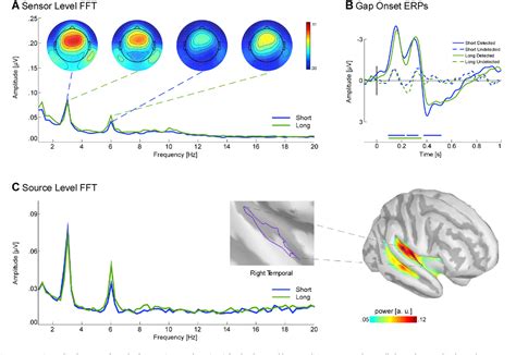 Figure 3 From Dynamic Phase Alignment Of Ongoing Auditory Cortex