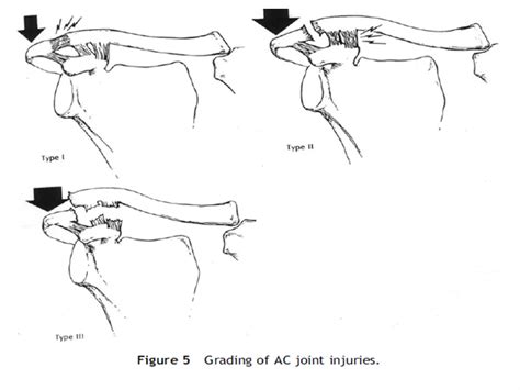 0004 Ac Sc And St Joints Dislocation Copy Pdf