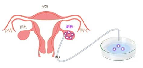 廣田漢方堂薬局・鍼灸院／体外受精・胚移植（ivf Et）
