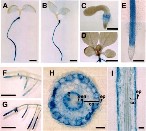 Histochemical Localization Of Gus Activity In Transgenic Seedlings And