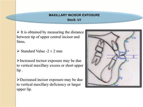 Burstone Analysis C O G S Soft Tissue Pptx
