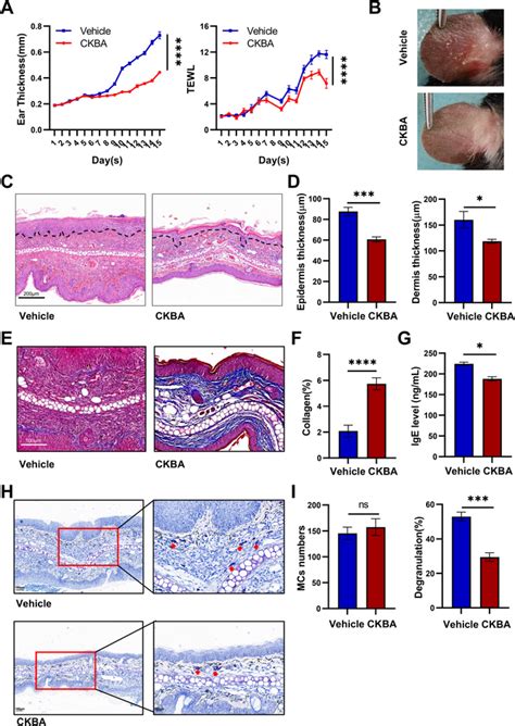 Ckba Alleviated Skin Barrier Dysfunction In Ad A Ear Thickness And