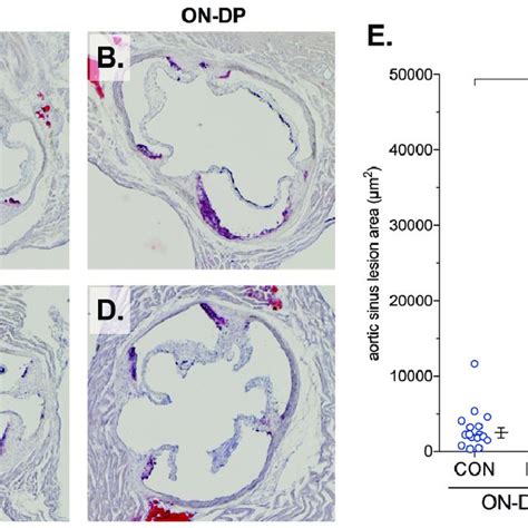 Atherosclerotic Lesion Formation In Aortic Sinus Representative Download Scientific Diagram