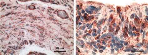Photomicrographs Demonstrating The Immunohistochemical Staining Of