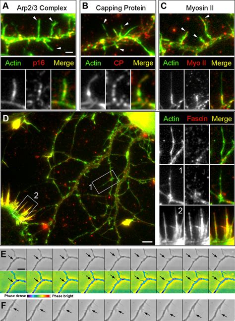 Molecular Markers And Dynamics Of Dendritic Filopodia A D