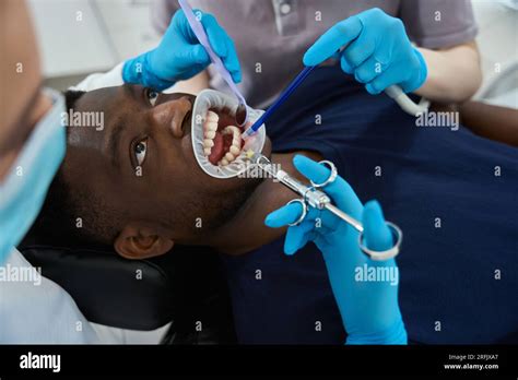 Woman Dentist Inserting Mouth Retractor To Male Client And Doing