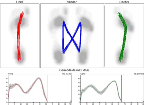 Gang En Loopanalyse Az Oostende