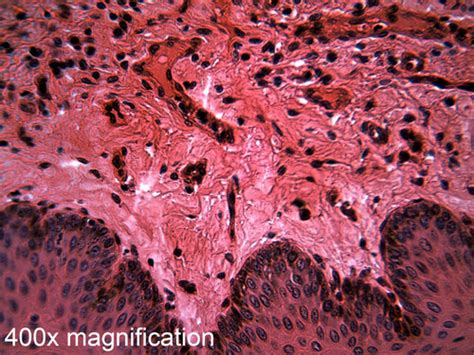 Human Tonsil Microscope Prepared Slide