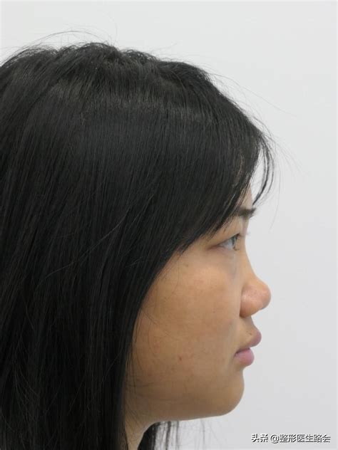 圆鼻头塌鼻梁塌鼻梁大山谷图库