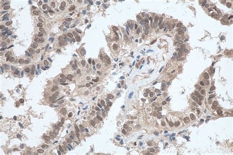 Ihceasy Hmgb1 Ready To Use Ihc Kit Khc0736 Proteintech