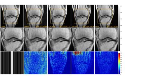 High Frequency Space Diffusion Models For Accelerated Mri Deepai