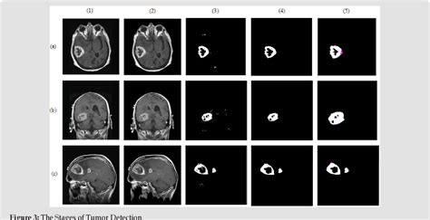 figure 1 from brain mr image classification based on deep features by