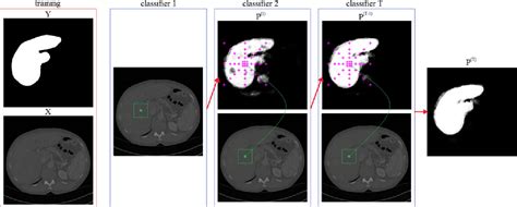 Figure From ACM Based Automatic Liver Segmentation From D CT Images By Combining Multiple