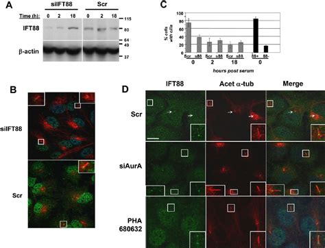 A Role For Ift Proteins In Aura Induced Ciliary Resoprtion A Western