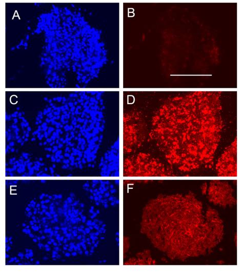 Expression Of Fibronectin And Laminin Within Neurospheres Frozen Download Scientific Diagram