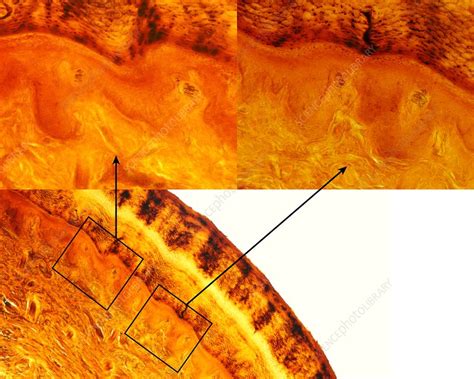 Meissner Corpuscle Light Micrograph Stock Image C048 3067