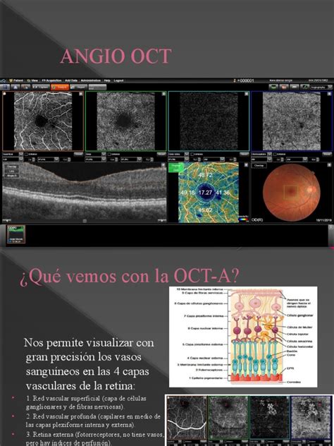Angio Oct Pdf Retina Anatomía Humana