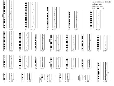 Figure 4 From Patient With Syndromic Cleft Lip Palate Mosaic