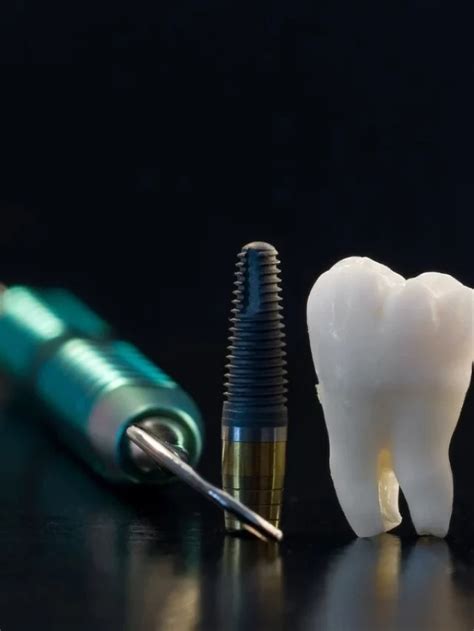 5 Detailed Complications Of Irrigating Wisdom Tooth Socket