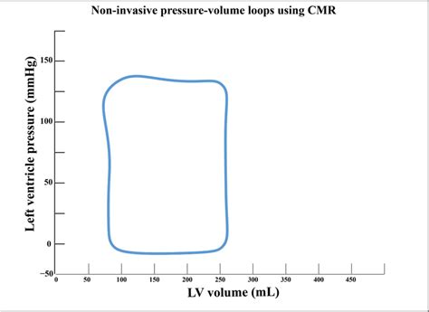 Non Invasive Assessment Of Pressure Volume Loops Using Cardiac Magnetic
