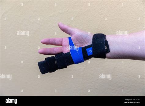 Two Sided Finger Splint With Two Hook And Loop Straps On A Broken