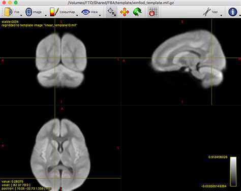 Problem With Whole Brain Tractography By Using Tckgen Mrtrix3 Community