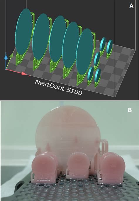 Figure 1 From Water Sorption Solubility And Translucency Of 3d Printed Denture Base Resins