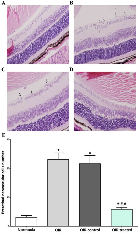 β‑elemene Inhibits Oxygen‑induced Retinal Neovascularization Via Promoting Mir‑27a And Reducing