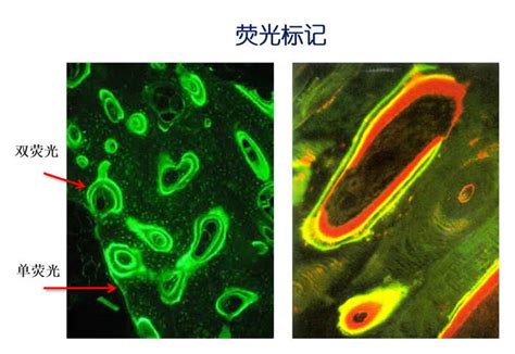 骨形态计量学分析案例 第2页