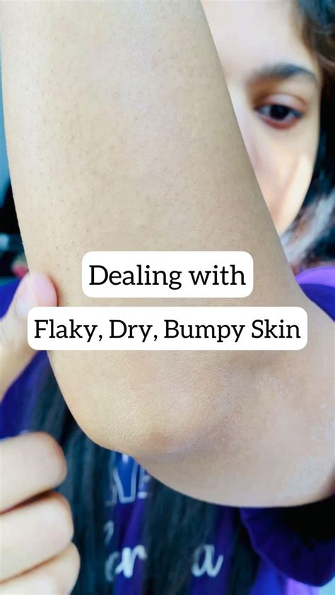 Solution For Dry Bumpy Skin Dermatological Skin Care Bumpy Skin