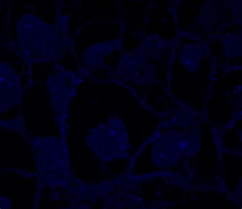 125 Questions With Answers In Seeding Density Science Topic