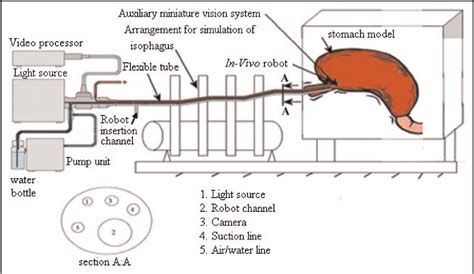 Figure 1 From Inverse Kinematics And Control Of 4 Degree Of Freedom Wire Actuated In Vivo Robot