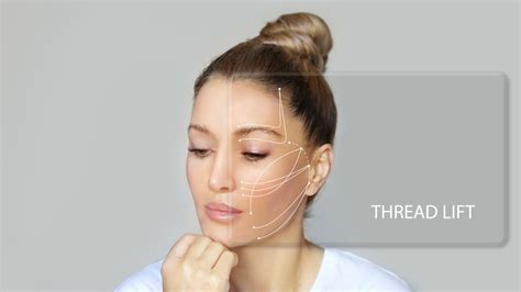 Pdo Threads Vs Silhouette Instalift Estar Medspa And Innovative Health