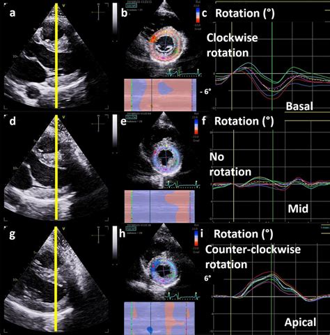Illustration Of Physiological Waveform Patterns Of Segmental Left Download Scientific Diagram