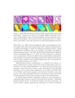 Gland Instance Segmentation Using Deep Multichannel Neural Networks