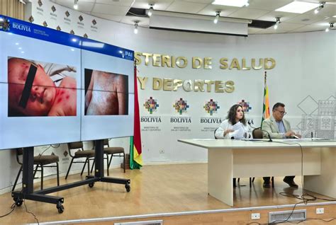 Ministerio De Salud Emite Alerta Epidemiológica Por Caso De Sarampión
