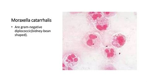 Sputum Gram Stainpptx