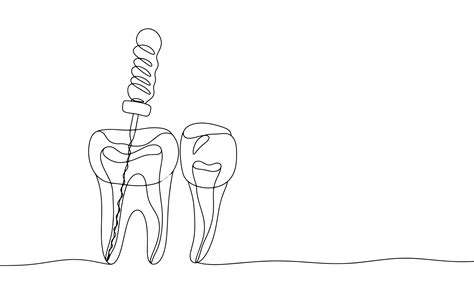 Practice Based Research The National Dental Pbrn