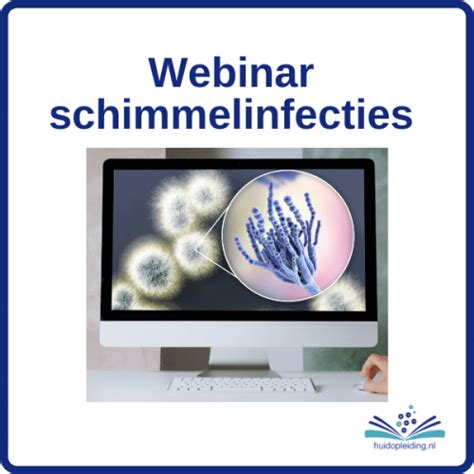 Psoriasis En Eczeem Huidopleidingnl