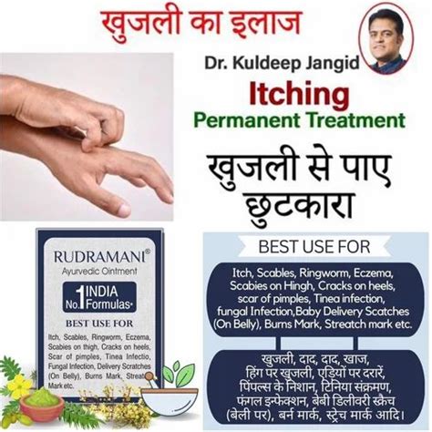 Itch Cream Ringworm Antifungal Cream Rudramani Ringworm Ointment 25gm